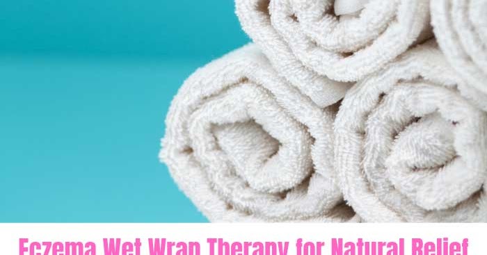 Eczema Wet Wrap Therapy Instructions - Everything Pretty