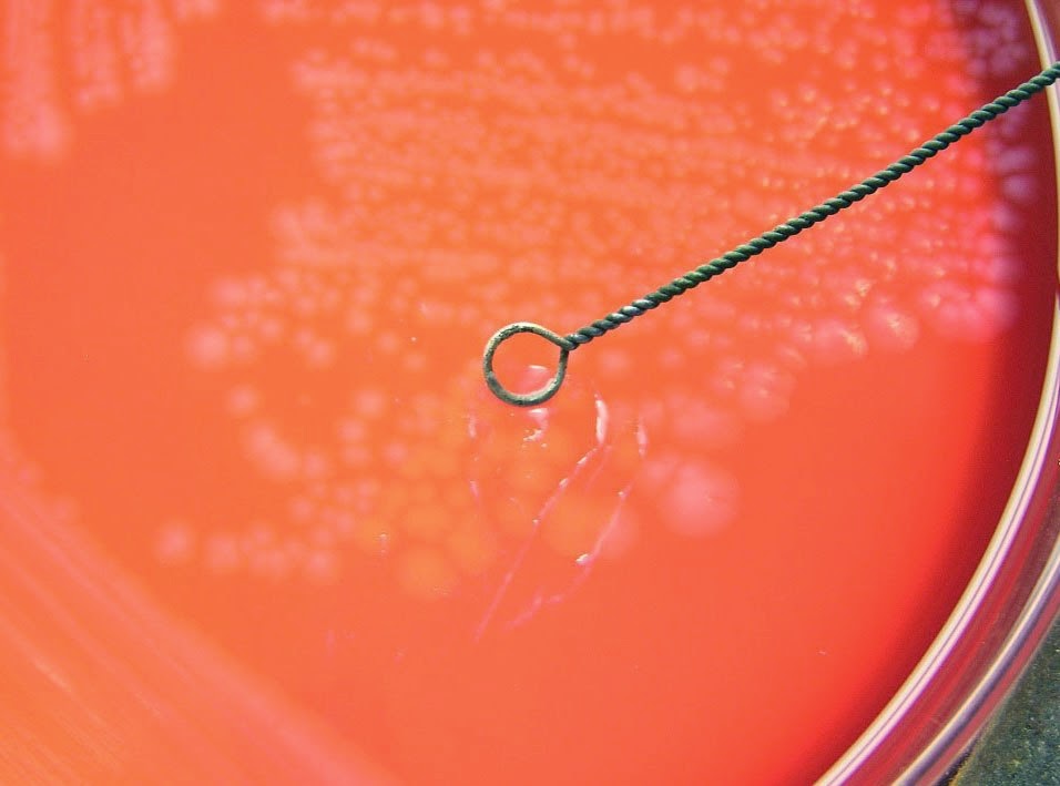 Blood Agar Plate Dan Uji Hemolisi