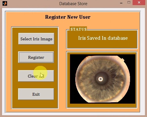 Iris Recognition System Using Discrete Cosine Transform DCT Full Matlab ...