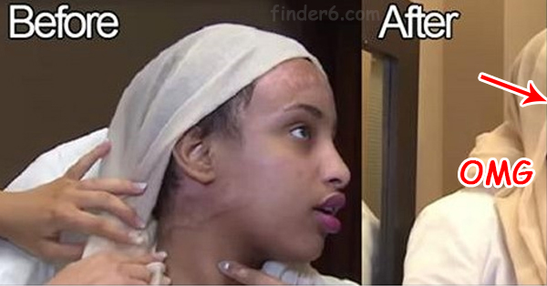 Woman Decided To Tattoo Her Half-Burned Face, Result Will Blow Your ...
