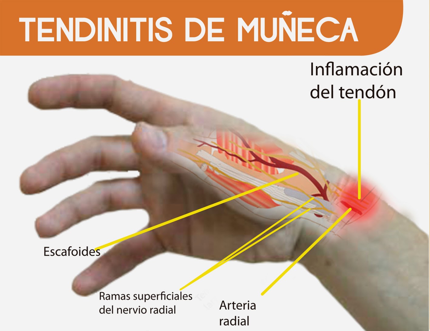 Dr. Luis Cotillo Herrera Traumatólogo Especialista en Rodilla ...