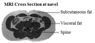 MRI Pathways - Understand your body, change your life