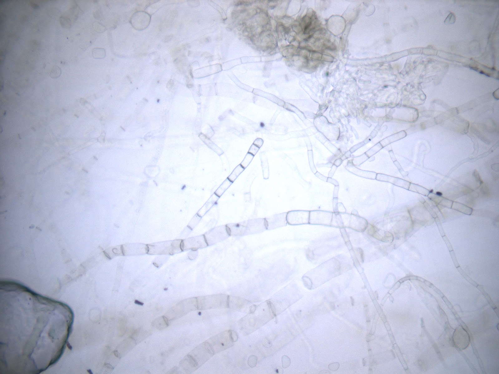 MaxwellHandiseniPLPA631: Lab 5: Conidiating Fungi