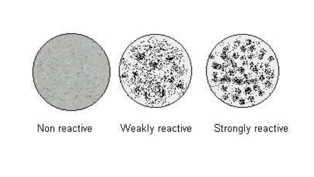 Pemeriksaan VDRL (Venereal Disease Research Laboratory) Test Metode Slide