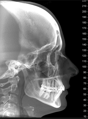 Facial X-Ray