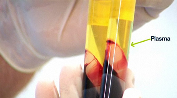 O Sangue e as partes que o compõem - Análises Clínicas.com