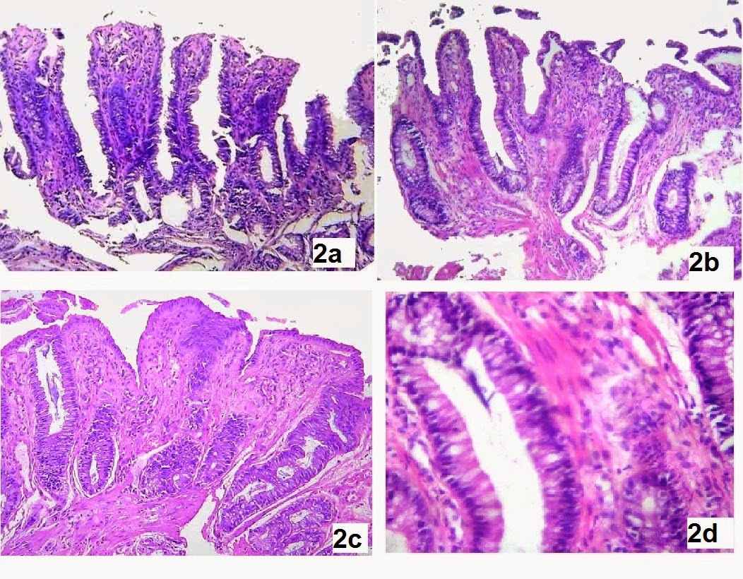 GASTROINTESTINAL AND LIVER HISTOLOGY PATHOLOGY ATLAS: COLON : RECTAL ...