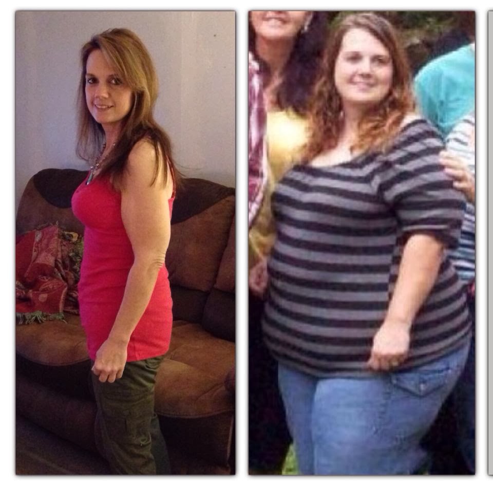 Jennifer's VSG Journey