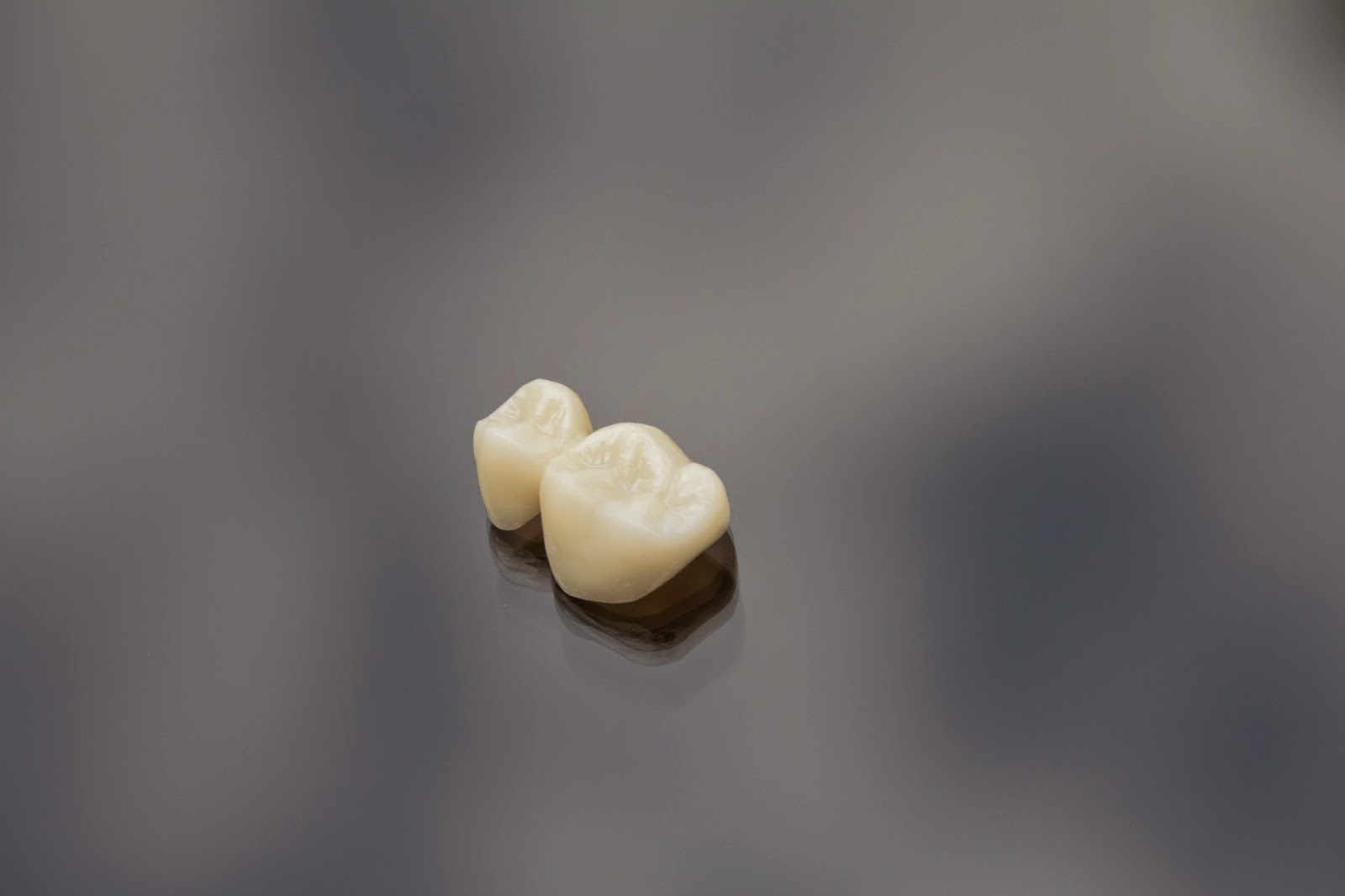 Intengent Honor Society: 5 Tips on How to Create All-Ceramic Inlays and ...