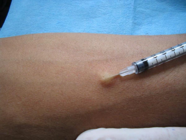 MARGARITA: DISOLUCION DE MEDICAMENTOS