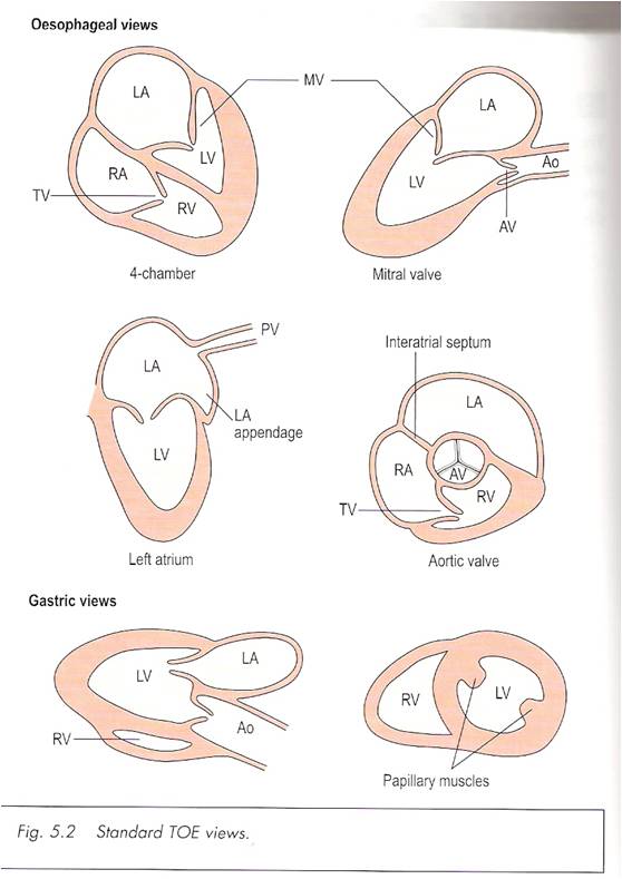 CVT Mohd Farid: Basic Echo Window :TEE View