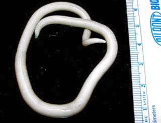 Lombriz intestinal (Ascaris lumbricoides)