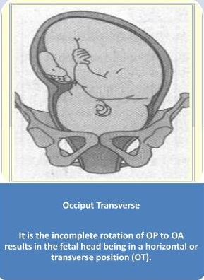 International Cesarean Awareness Network » Blog