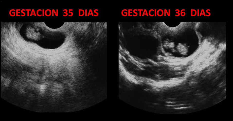 MANUAL DE REPRODUCCION BOVINA: GESTACION