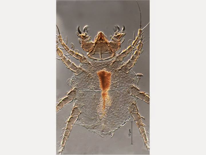 Variety of Life: Cheyletidae