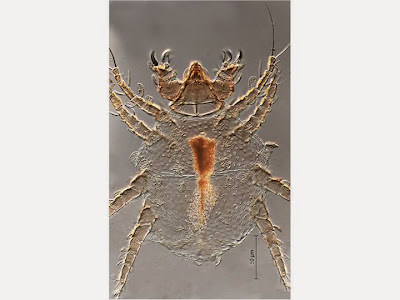 Variety of Life: Cheyletidae