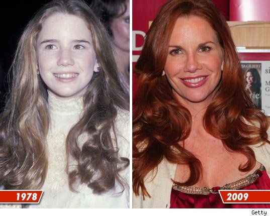 Melissa Gilbert Plastic Surgery Before and After Nose Job and Botox ...