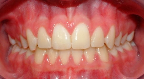 ORTODONCIA Y FERULAS: CLASE 2. HISTORIA DE LA ORTODONCIA Y NOMENCLATURAS