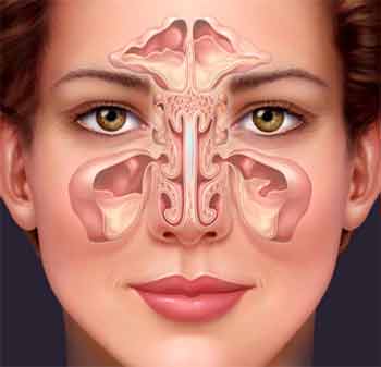 Askep Post Operasi Sinusitis (Upgrade) - Askepku.com