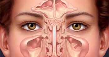 Askep Post Operasi Sinusitis (Upgrade) - Askepku.com