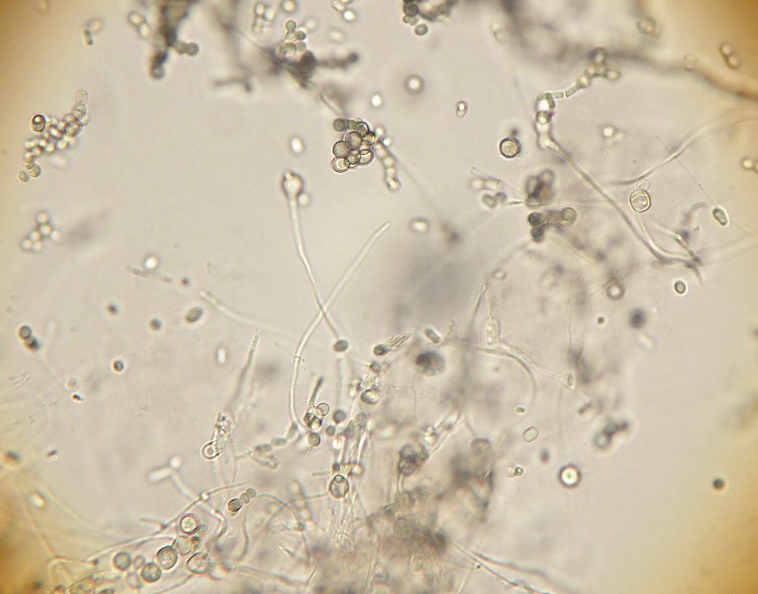 ATLAS MICOLOGIA: SCYTALIDIUM DIMIDIATUM (Neoscytalidium dimidiatum)