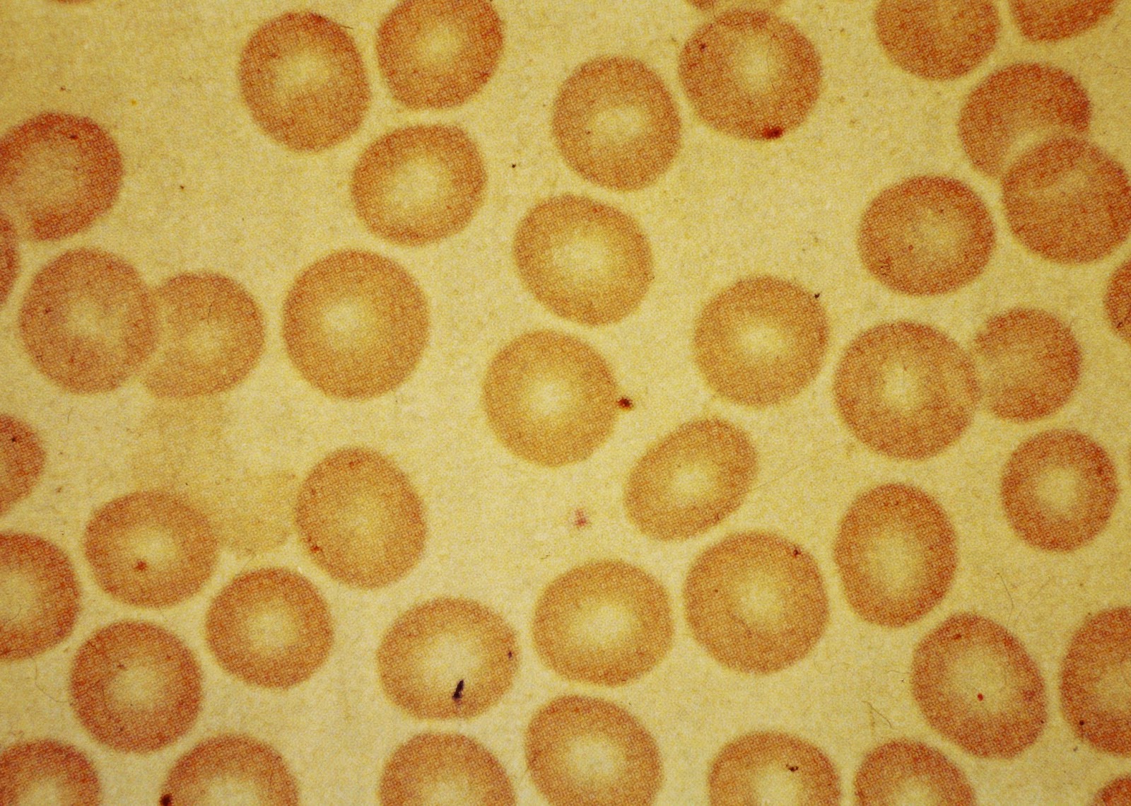 HISTOPATOLOGIA FORENSE PRACTICA (FORENSIC PATHOLOGY FORUM): 6.-SIGNS IN ...