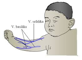 Ilmu kesehatan dan umum : lokasi vena untuk pemasangan infus