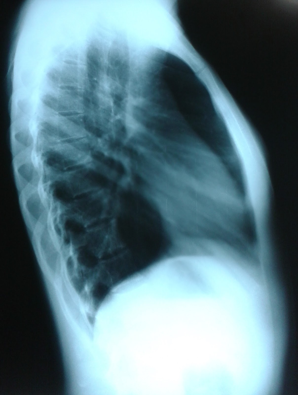 DICAS DE RADIOLOGIA - Tudo Sobre Radiologia: QUALIDADE DA IMAGEM ...