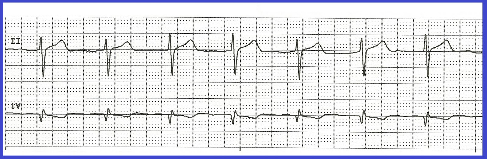 Basic EKG Rhythm Test 01
