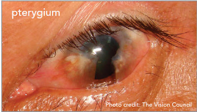 Makes me want to wear sunglasses at night!