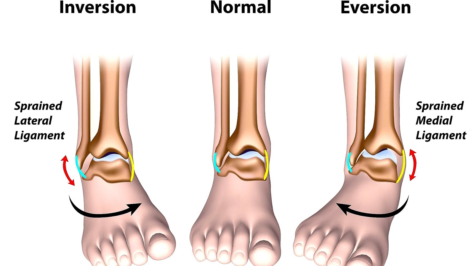 Different Types Of Ankle Injuries Injury Injury Choices different-types-of-ankle-injuries-injury-injury-choices