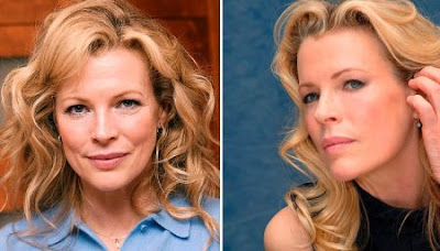 Kim Basinger Plastic Surgery Before and after Facelift and Nose Jobs ...