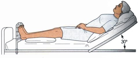 Teaching Nursing: Posiciones: Fowler y Sims