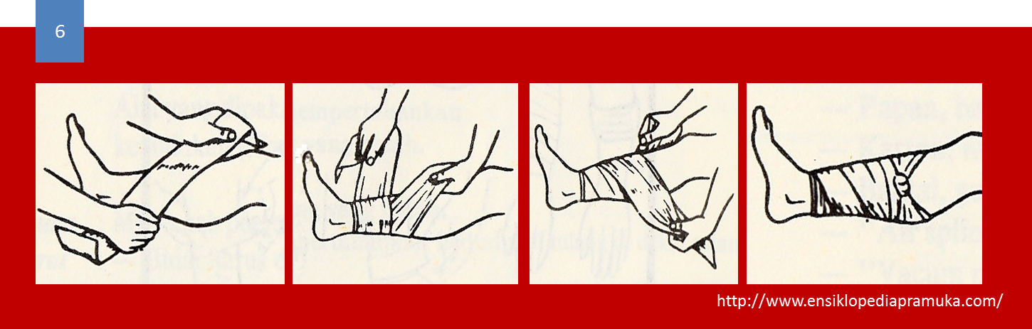 Ensiklopedia Pramuk: PPPK : Jenis dan Cara Pembalutan