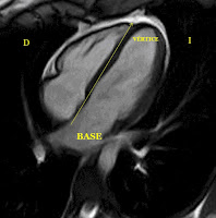 LABORATORIO DE IMÁGENES: agosto 2017