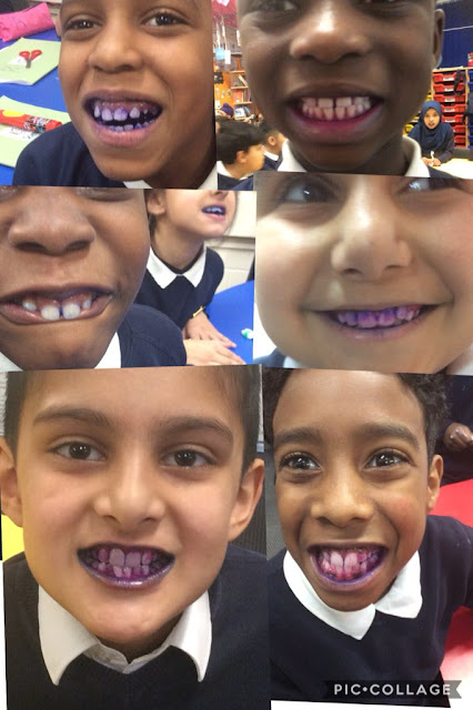 Welford Year 4: Plaque Attack!