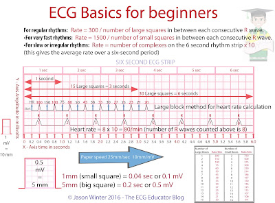 ECG Educator Blog : Basic Electrophysiology
