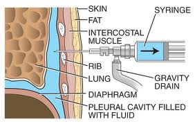 Johnson stories--real life, nothing scripted here!: This week's update ...