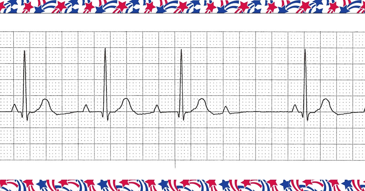 EKG Quiz Happy Birthday America! 360