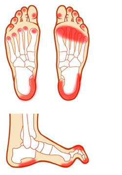 Podologia é Saúde: Saiba um pouco mais sobre cada tratamento