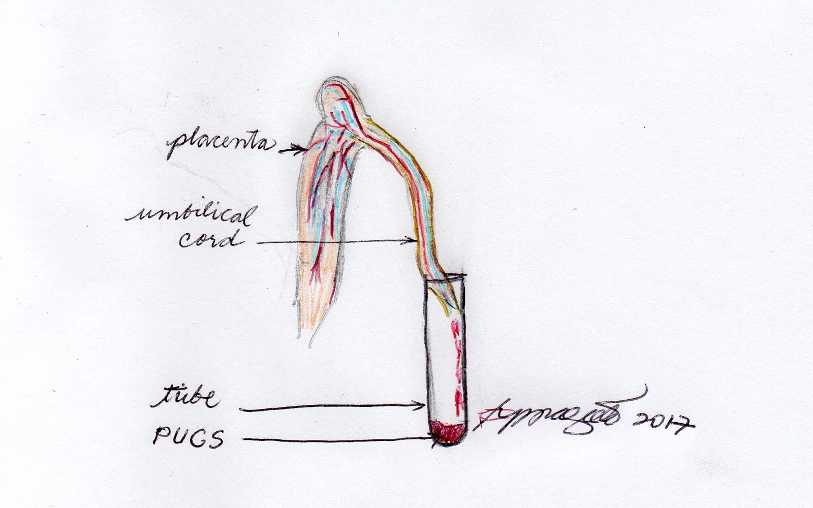 written straight from THE PIGS' PEN: The pig's placenta: in sickness ...