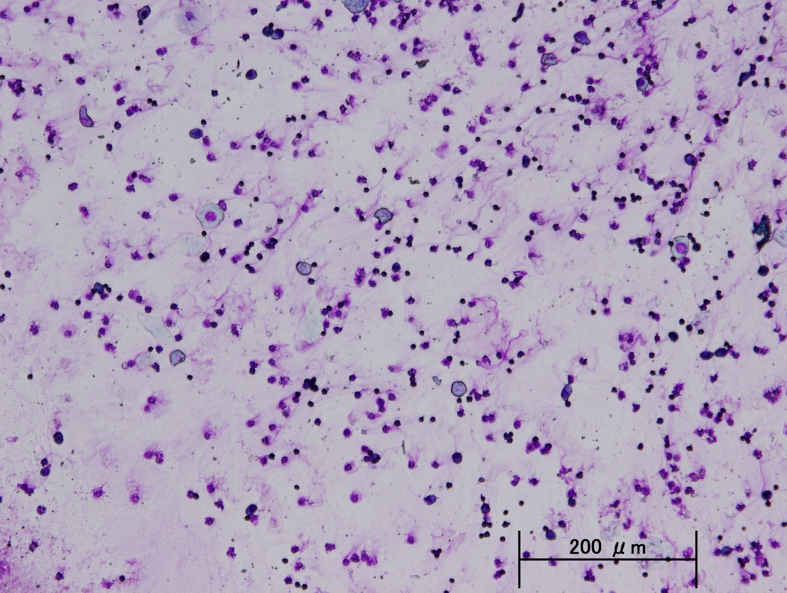 Pramod Dhakal's: Guide for Rat Smear (Diestrus, Proestrus, Estrus and ...