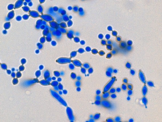 Fun With Microbiology (What's Buggin' You?): Cladosporium species ...