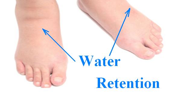 Everything You Need to Know About Water Retention - towards health