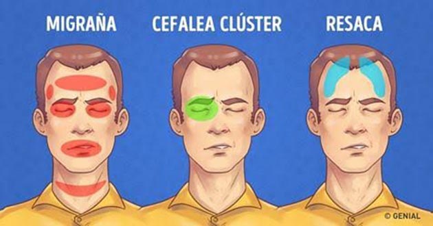 Tipos de dolor de cabeza y qué hacer para aliviarlos ~ TODO EN SALUD ...