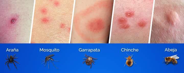 ESCUELA ACREDITADA CARMEN APONTE SANTIAGO: Guía para identificar picaduras