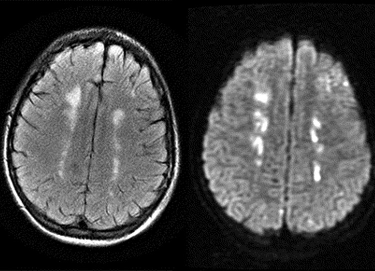 Coma Chameleon: My Recovery Chronicles: July 2015