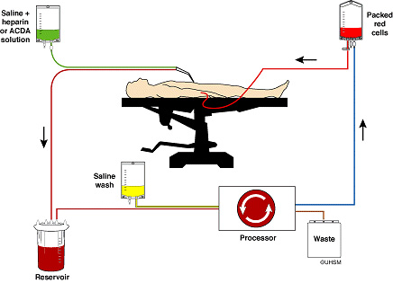 INTRAOPERATIVE BLOOD SALVAGE TECHNIQUES