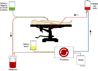INTRAOPERATIVE BLOOD SALVAGE TECHNIQUES