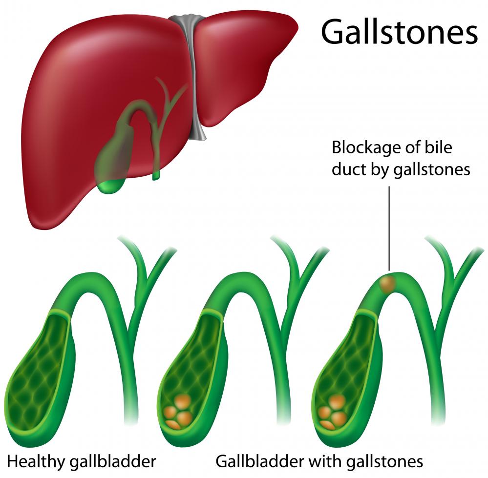 Bekam, Akupuntur, Pembetulan Tulang Belakang di Seri Manjung: Sakit ...